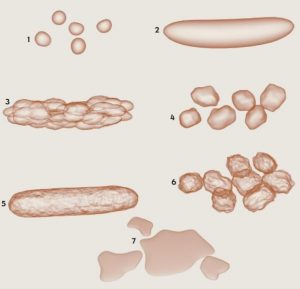 Colore e forma delle feci: tutti i significati | OK Salute