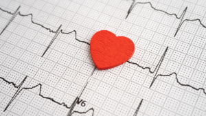 Aritmie cardiache: cosa sono e come riconoscerle