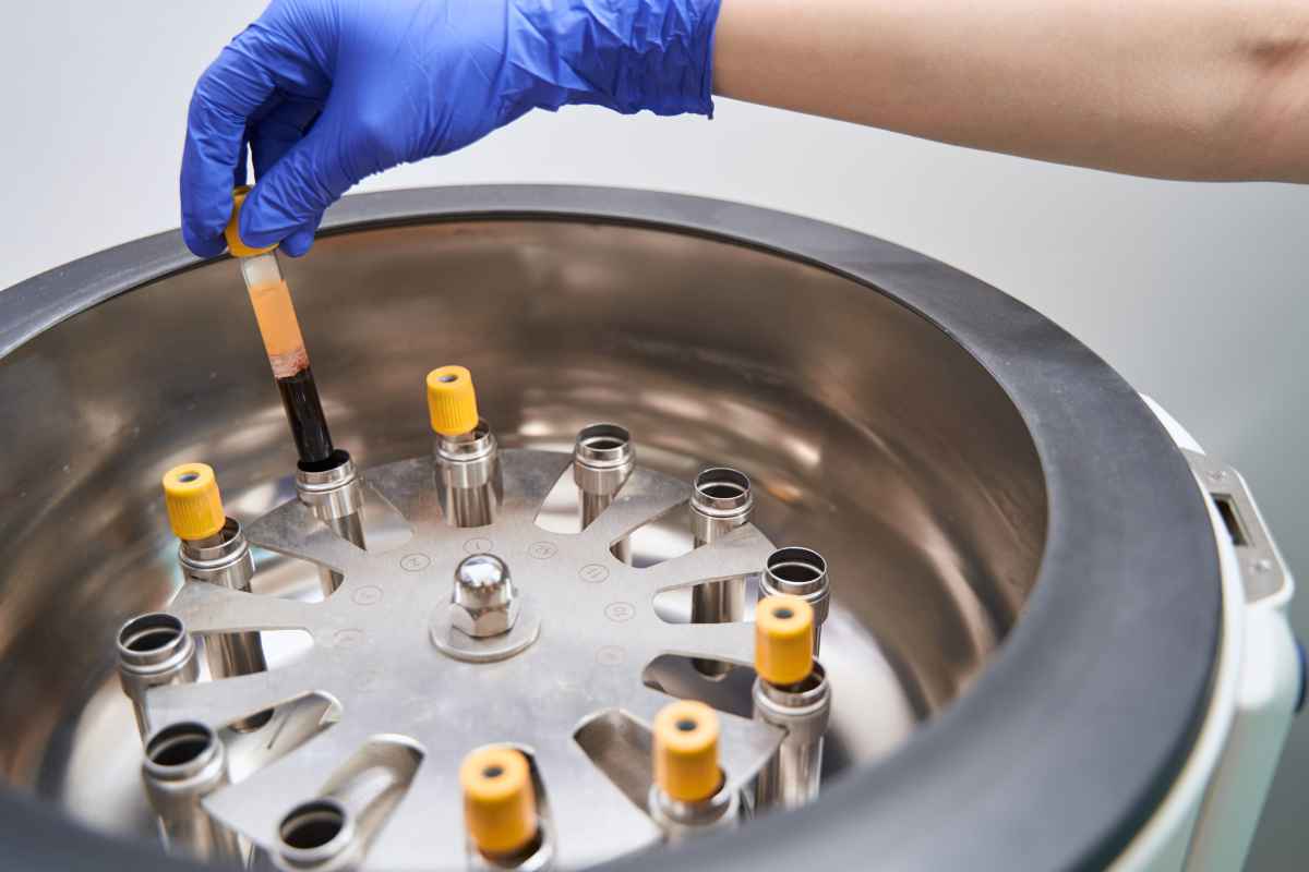 Farmaci plasmaderivati e malattie rare: viaggio nella "Plasma Valley ...